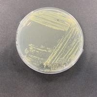 Free OCR A Level Chemistry Unit 1 Flashcards & Study Tips (Chemistry ...